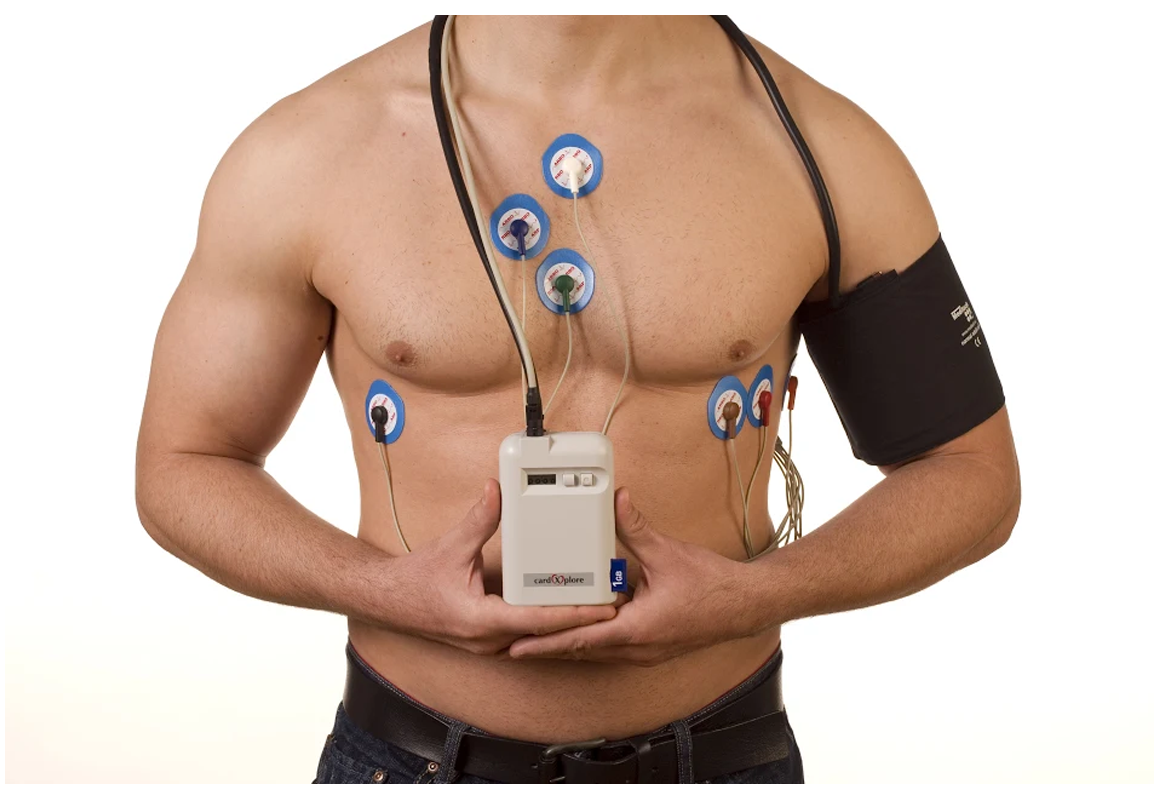 24 Hour ECG 24 Hour Ambulatory Blood Pressure 2 In 1 